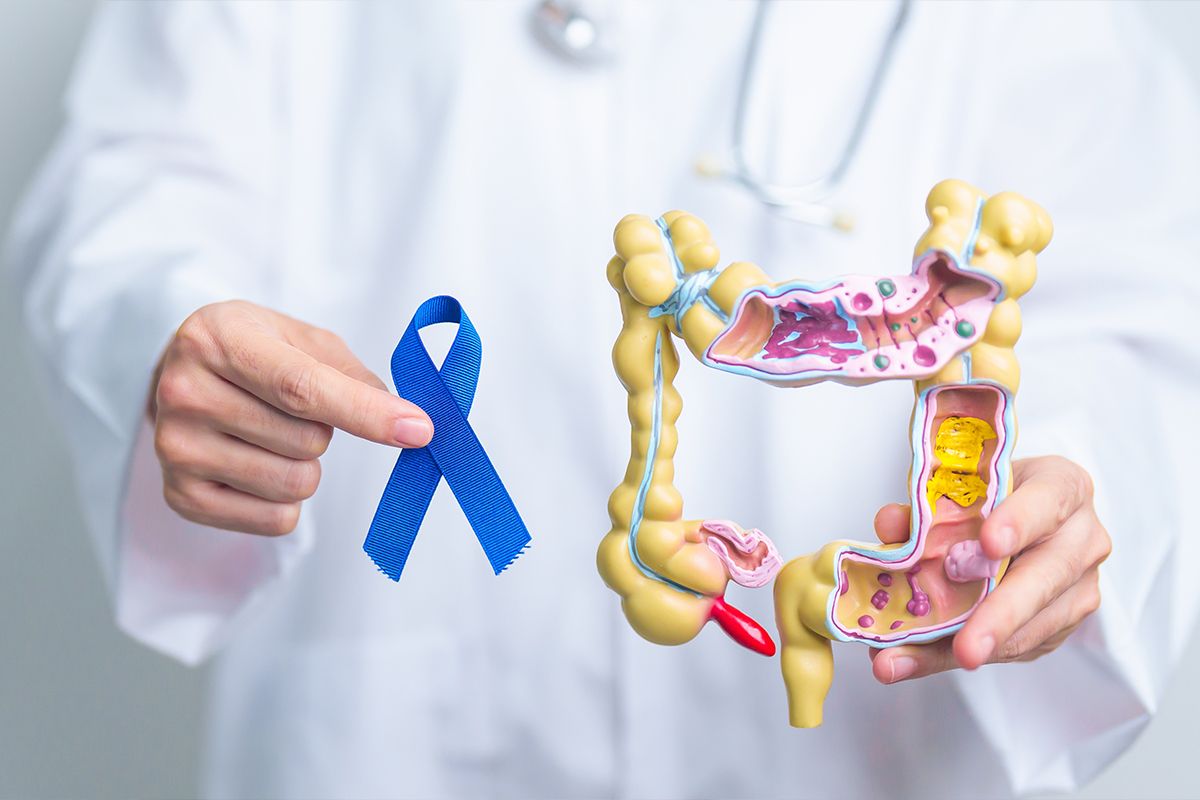 Cancerul colorectal – cum îl prevenim? - Royal Hospital